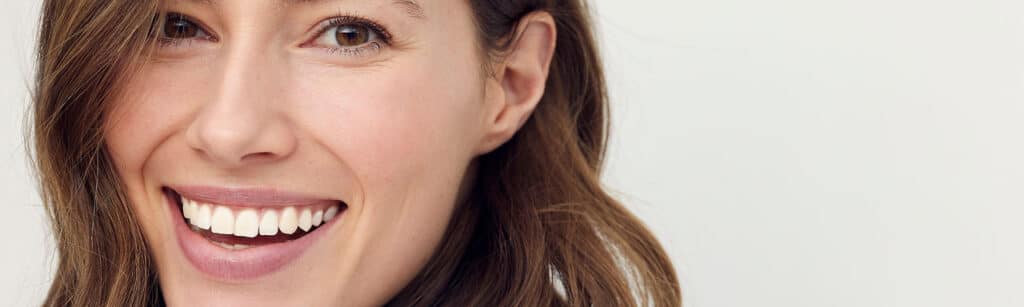 BBL Photofacial for Rosacea and Melasma - Elm Grove, WI